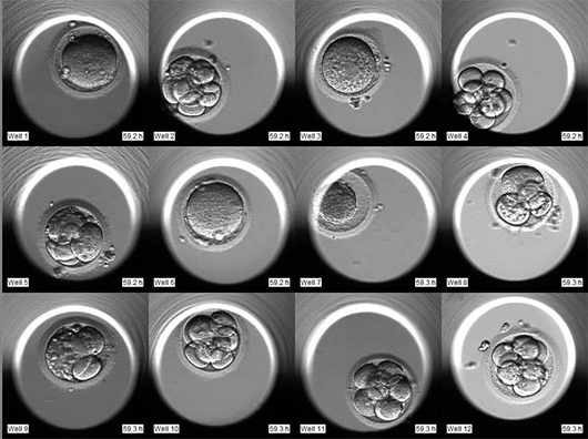 Embryoscope – Kolan British Hospital IVF Center